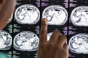 Diagnostics & Imaging | Georgia Neurosurgical Institute